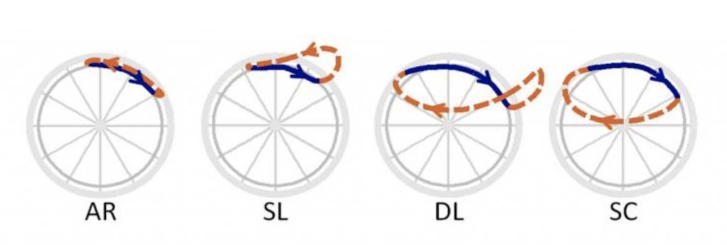 How to Prevent Shoulder Pain From Using a Wheelchair